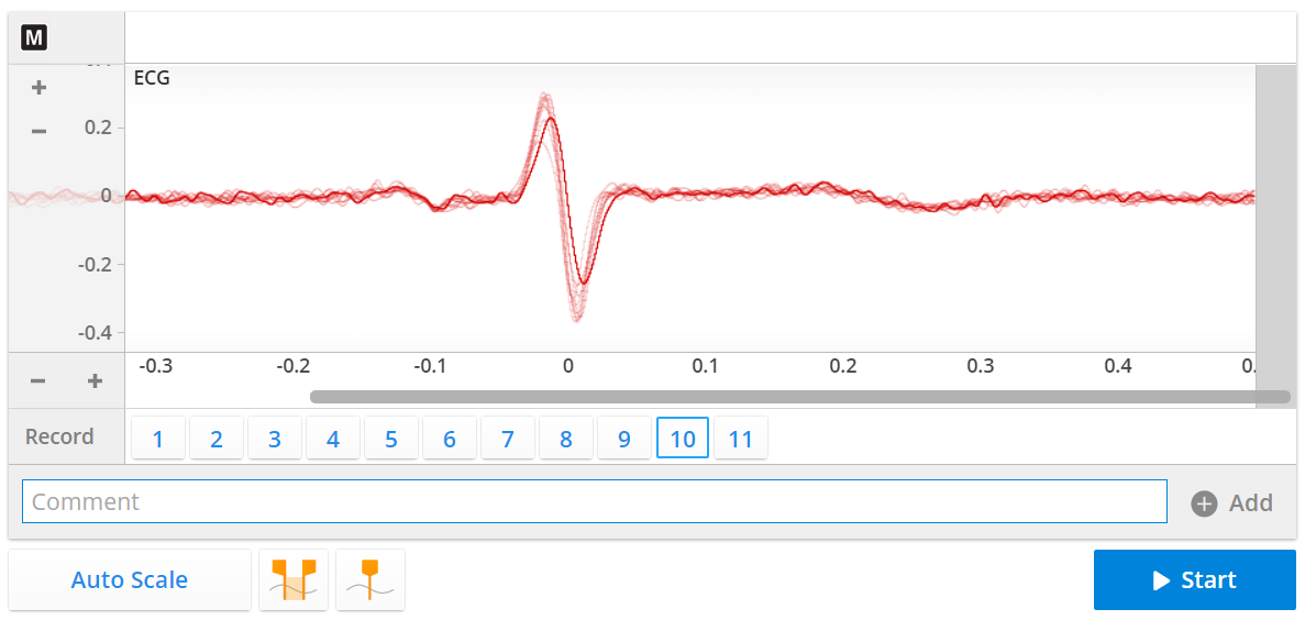 Settings for Sampling Panels in Lt - ECG Event Averaging | ADInstruments